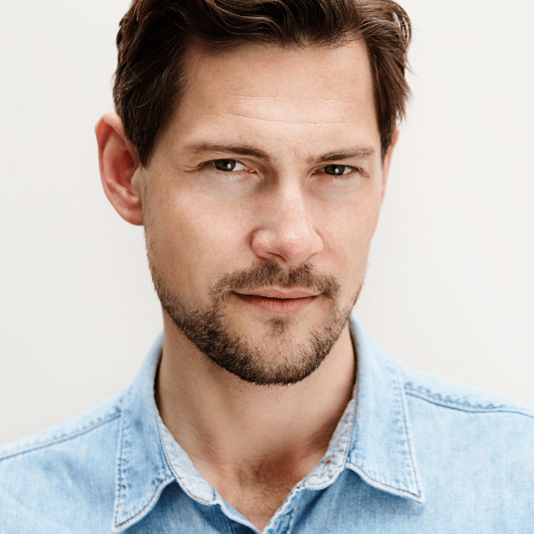 Cleft Lip Hair Restoration (hair) | Glojas Hair Transplant, Aesthetic ...