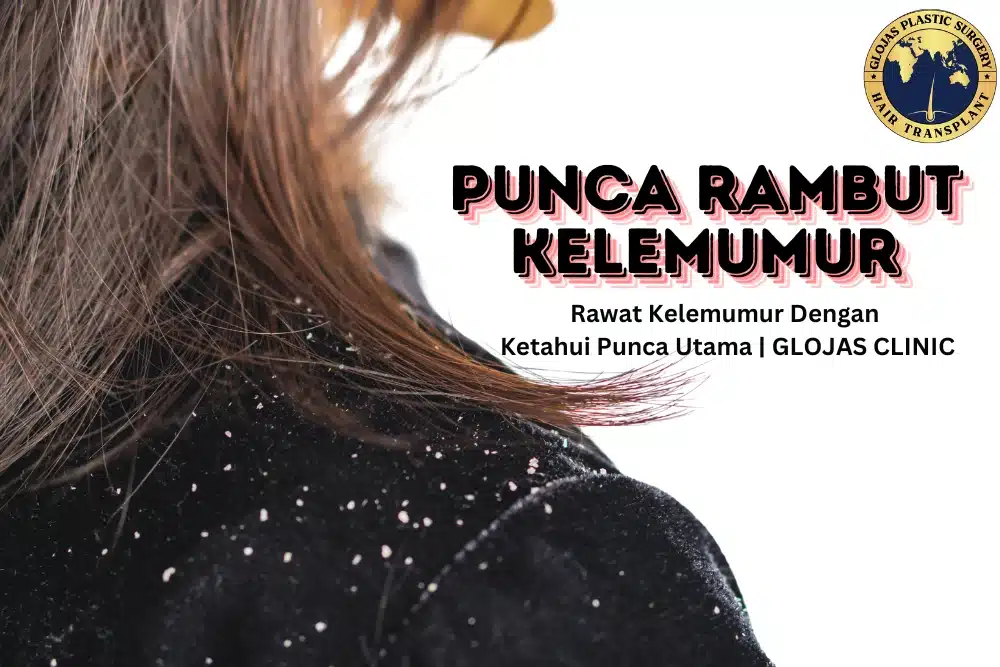 Punca Rambut Kelemumur | Rawat Kelemumur