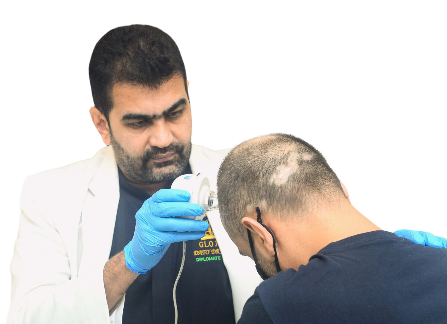 FUE Hair Transplant - Glojas