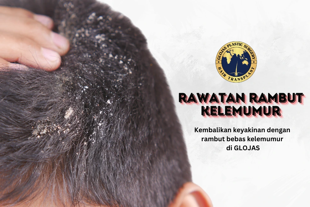 Rawatan Rambut Kelemumur | Bebas Kelemumur Di Glojas